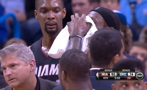 LeBron James Breaks Nose - TheCount.com